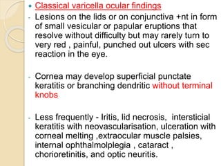 Viral infections of eye | PPTX