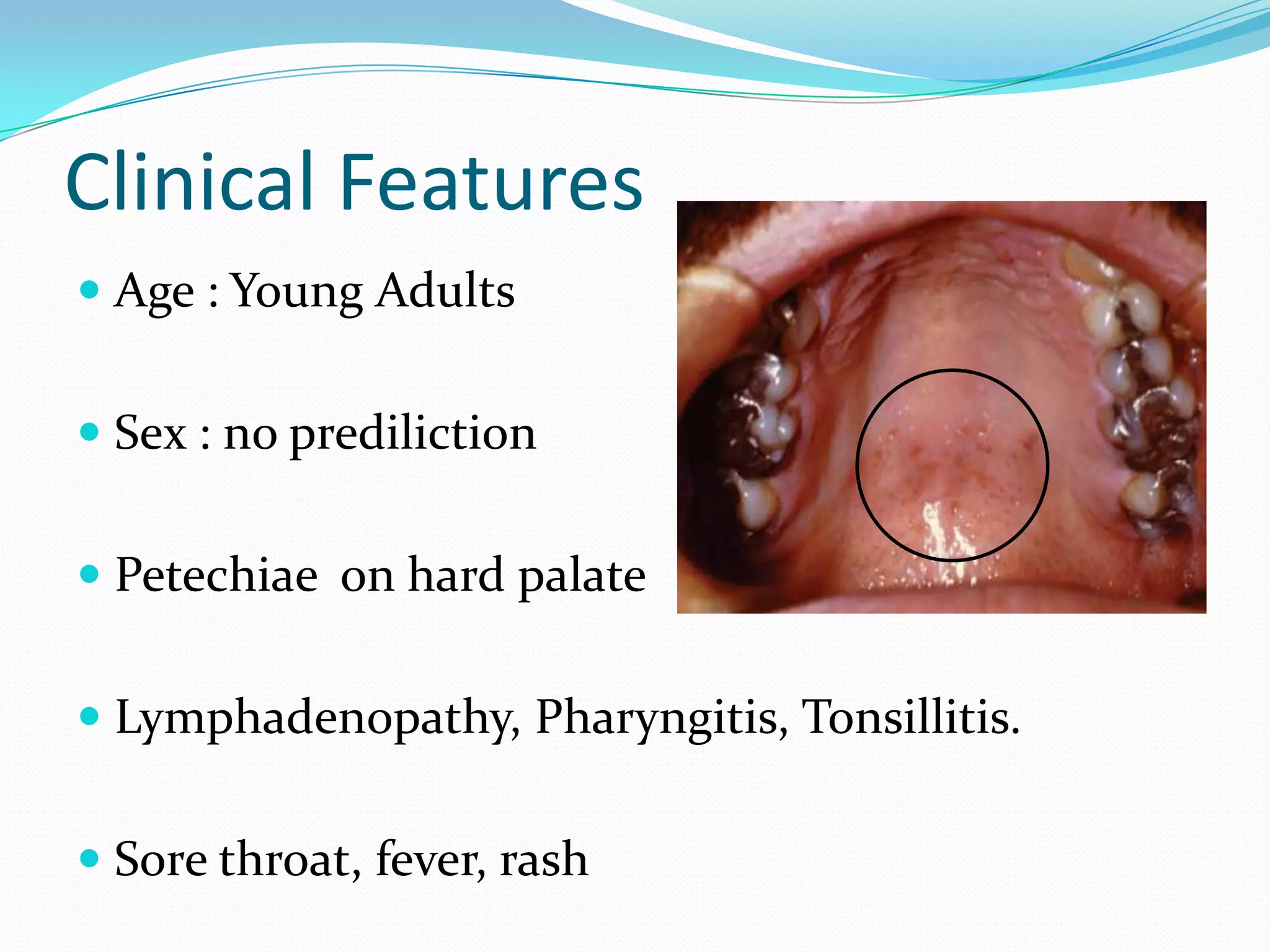Viral infections of oral cavity - Dr. Abhishek Solanki | PPTX