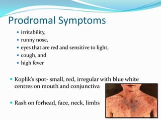 Viral infections of oral cavity - Dr. Abhishek Solanki | PPTX