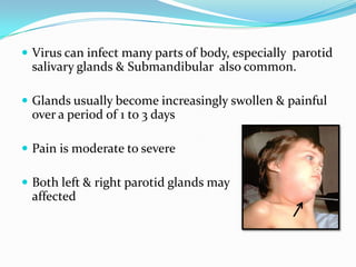 Viral infections of oral cavity - Dr. Abhishek Solanki | PPTX