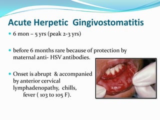 Acute Herpetic Pharyngotonsillitis