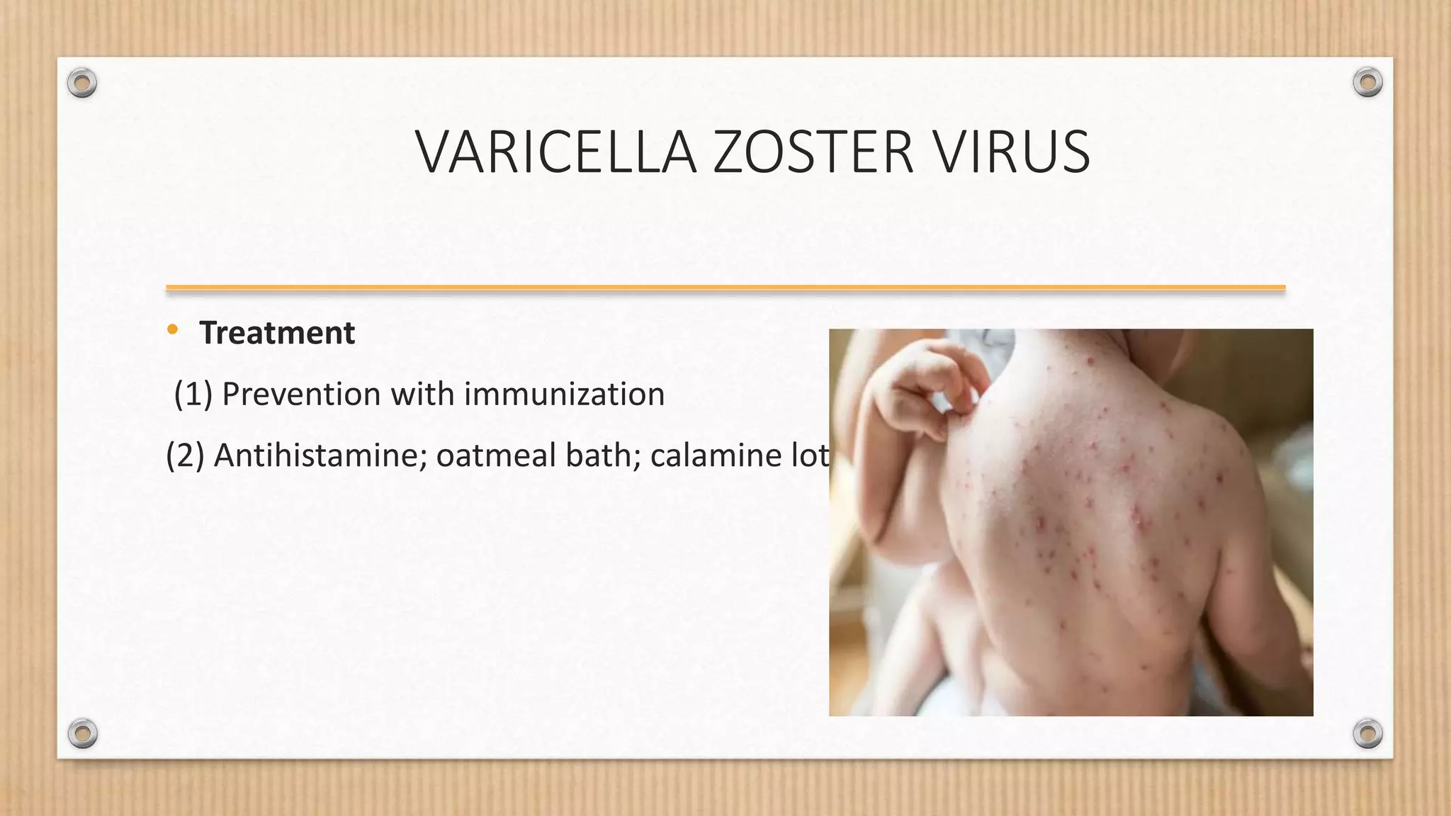 Viral infections of skin.pptx