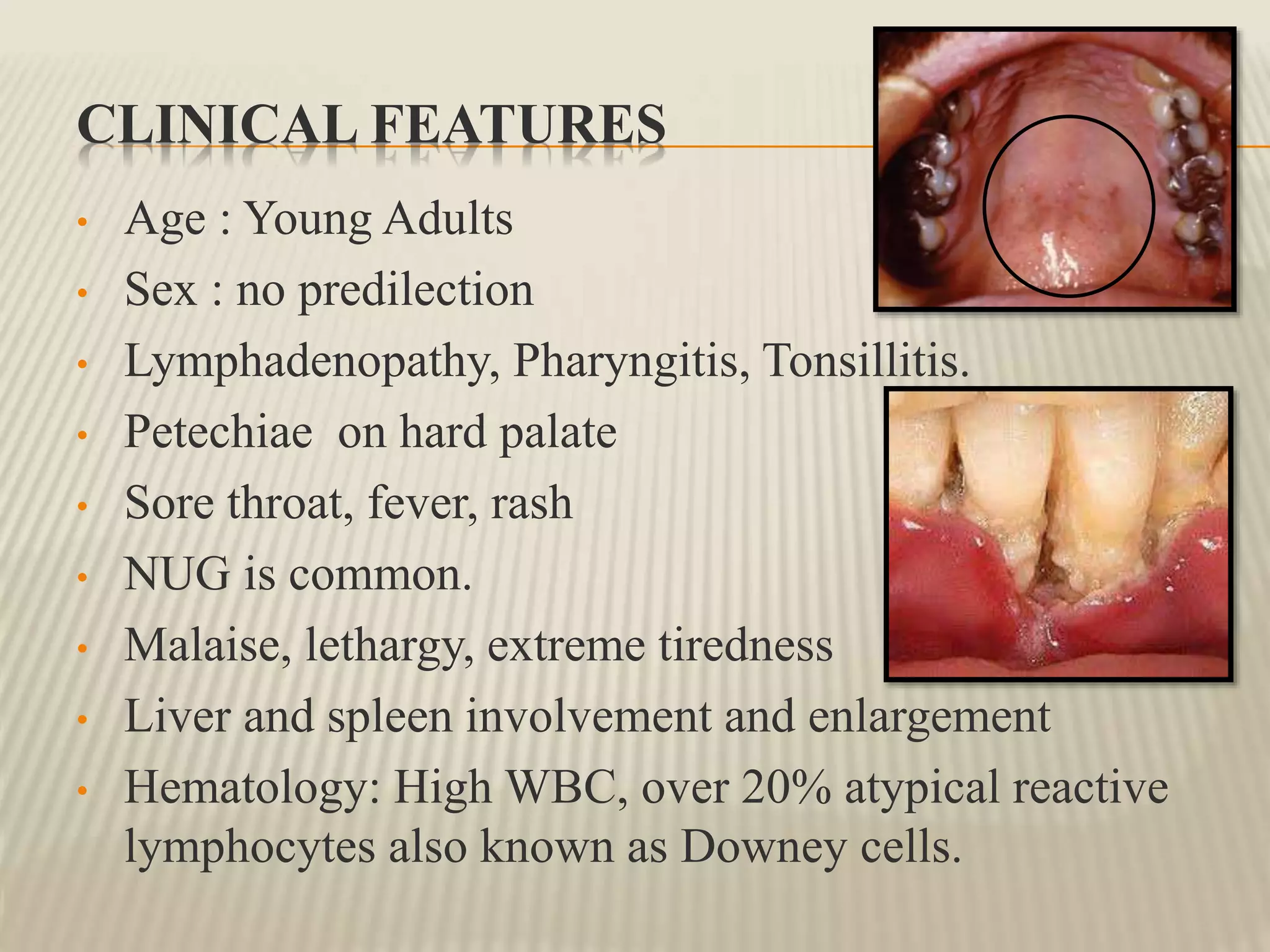 Viral infections (oral cavity) | PPTX
