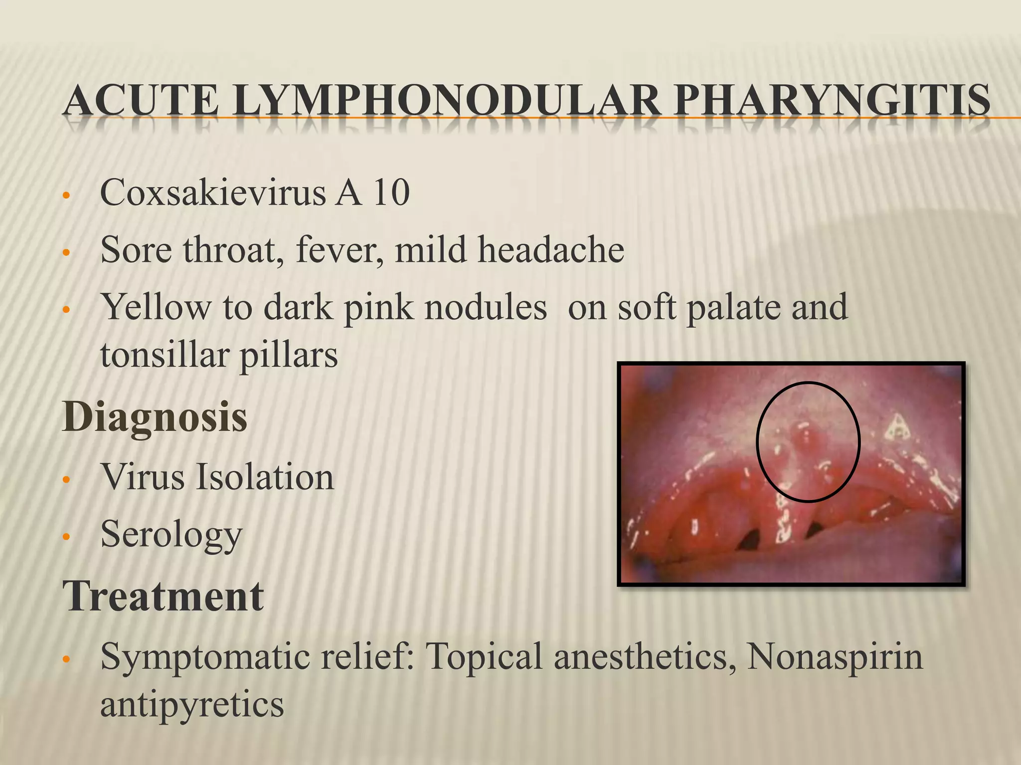 Viral infections (oral cavity) | PPTX
