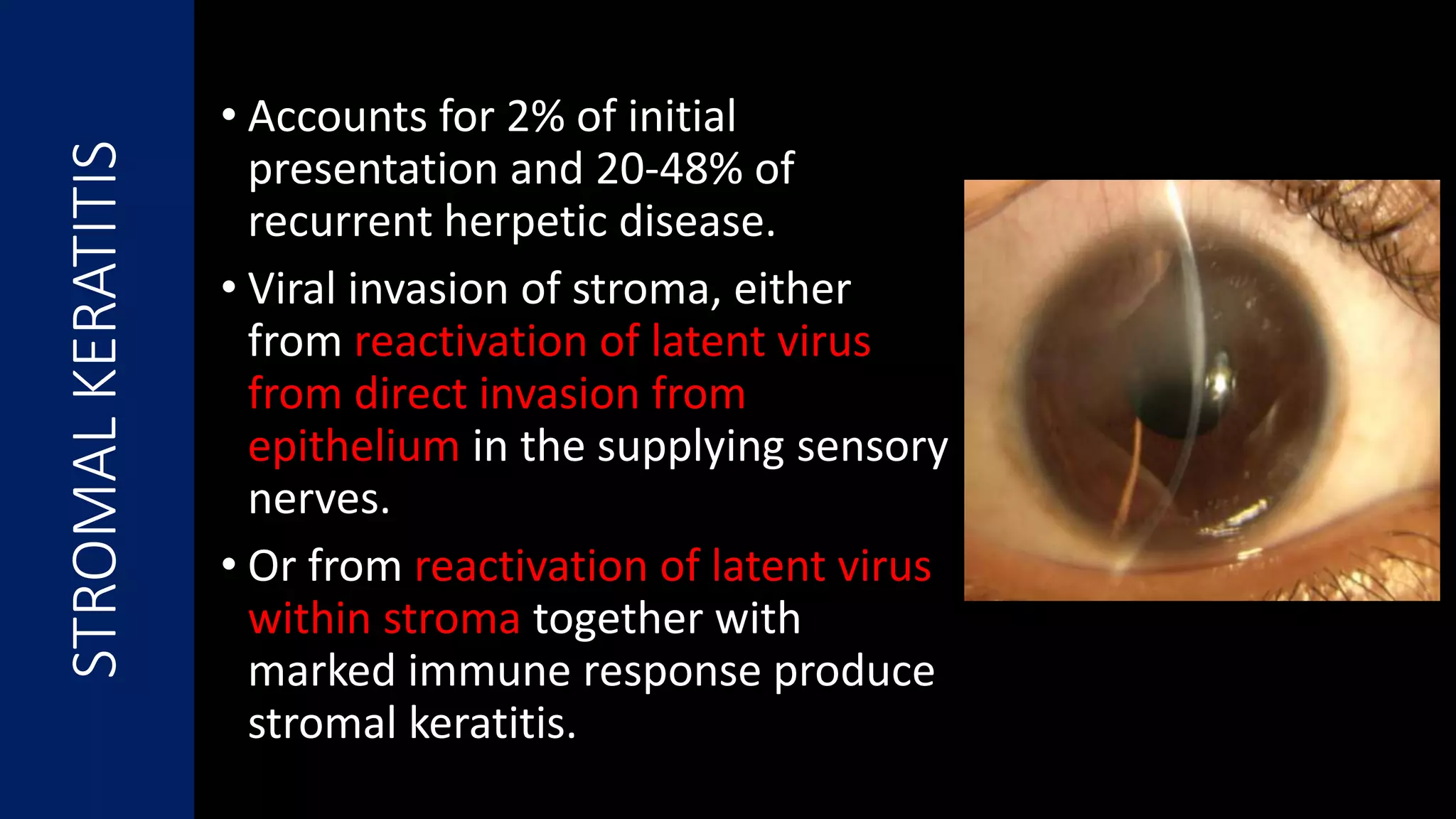 Viral Keratitis: Diagnosis, Management and Latest Guidelines | PPTX