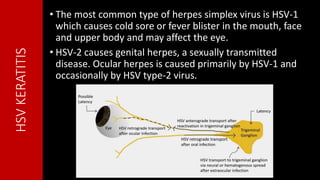 Viral Keratitis: Diagnosis, Management and Latest Guidelines | PPTX