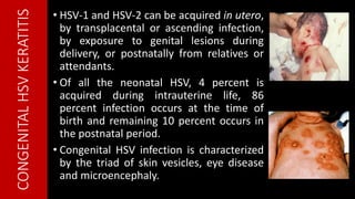 Viral Keratitis: Diagnosis, Management and Latest Guidelines | PPTX