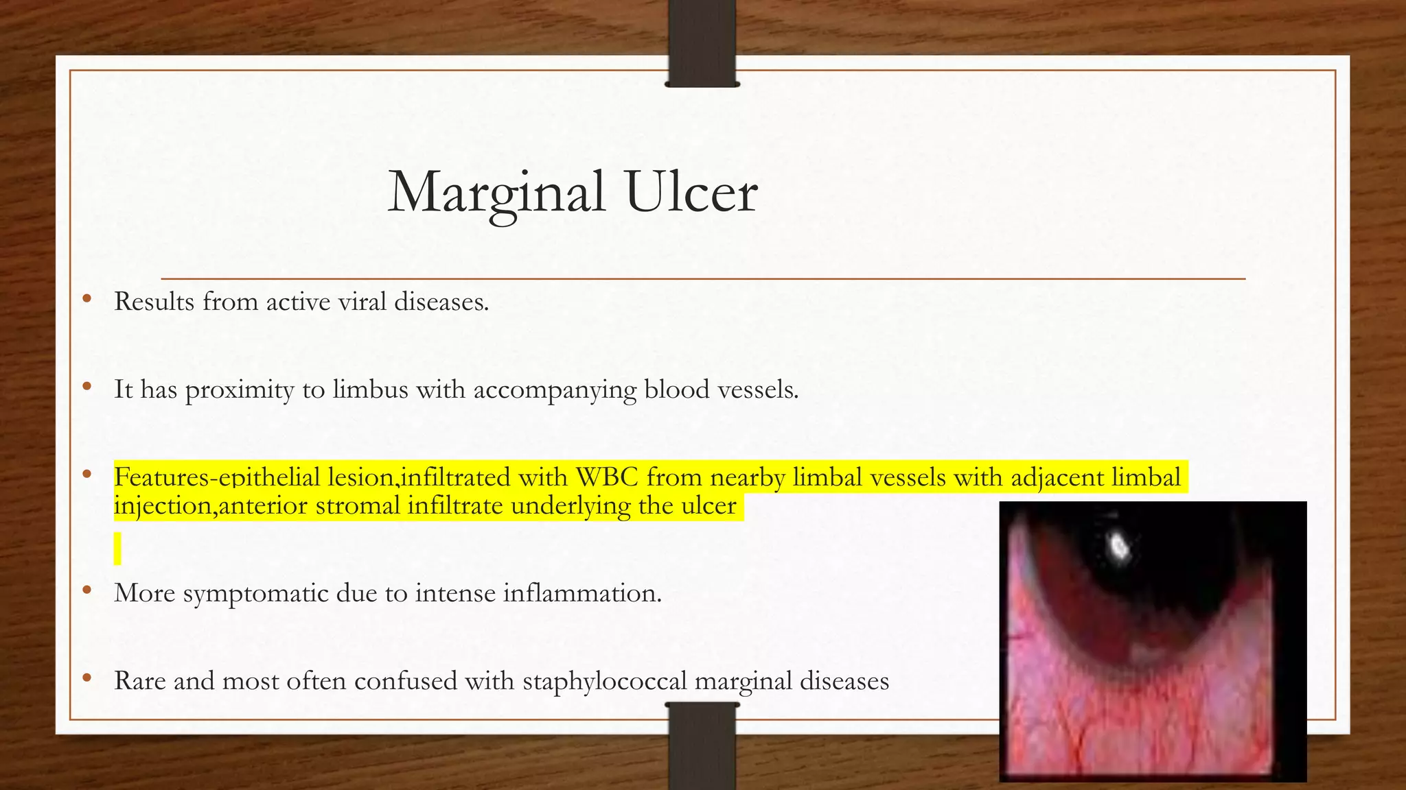 Viral keratitis | PPTX