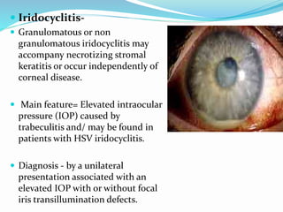 Viral keratitis | PPT