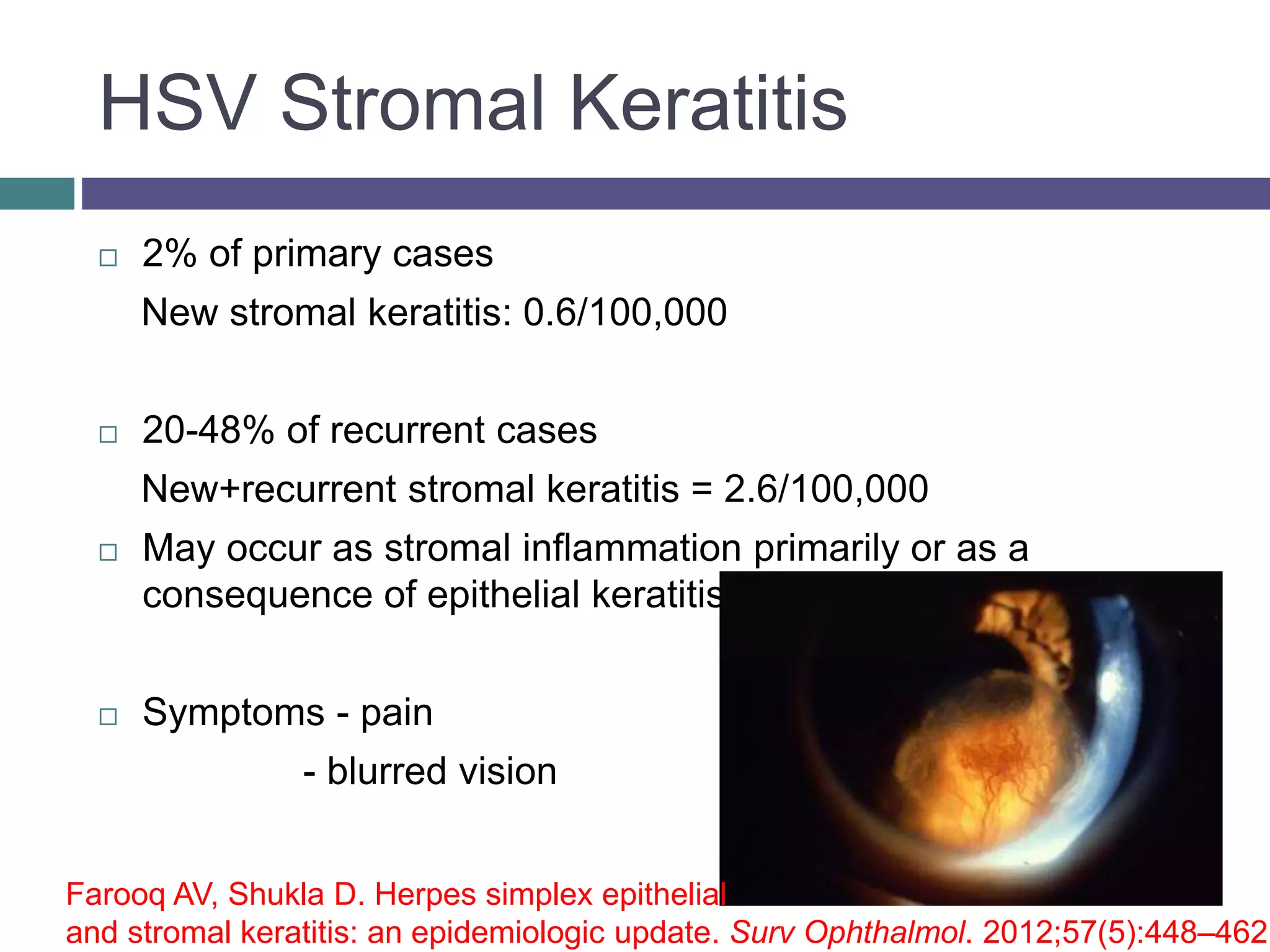 Viral keratitis: Diagnosis and management | PPTX