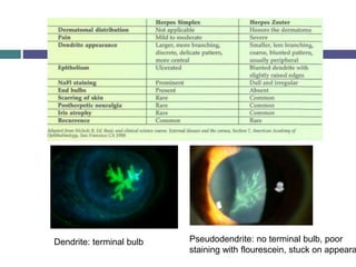 Viral keratitis: Diagnosis and management | PPTX