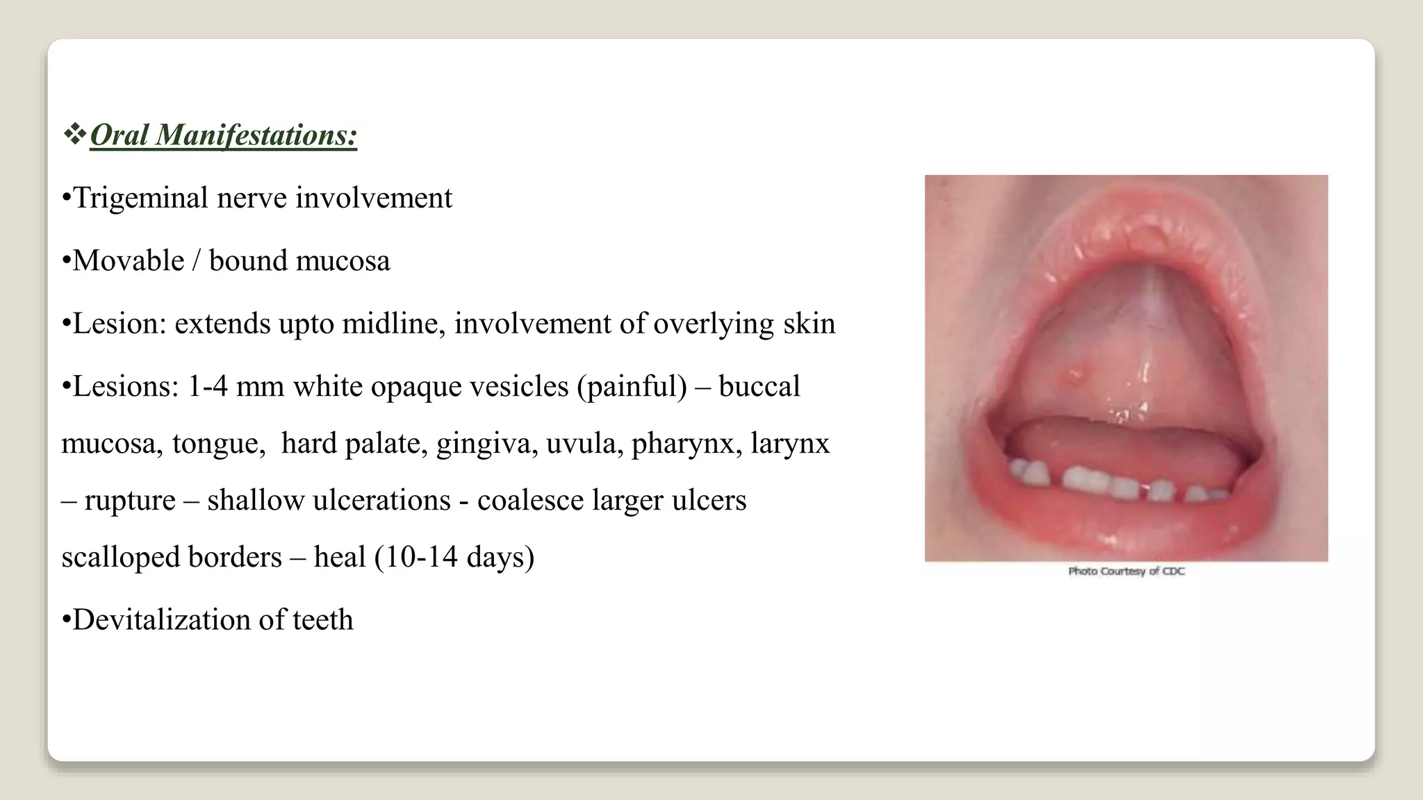Viral lesions in children | PPTX | Infectious Diseases | Diseases and ...
