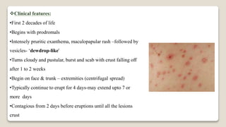 Viral lesions in children | PPTX | Infectious Diseases | Diseases and ...