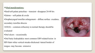 Viral lesions in children | PPTX | Infectious Diseases | Diseases and ...