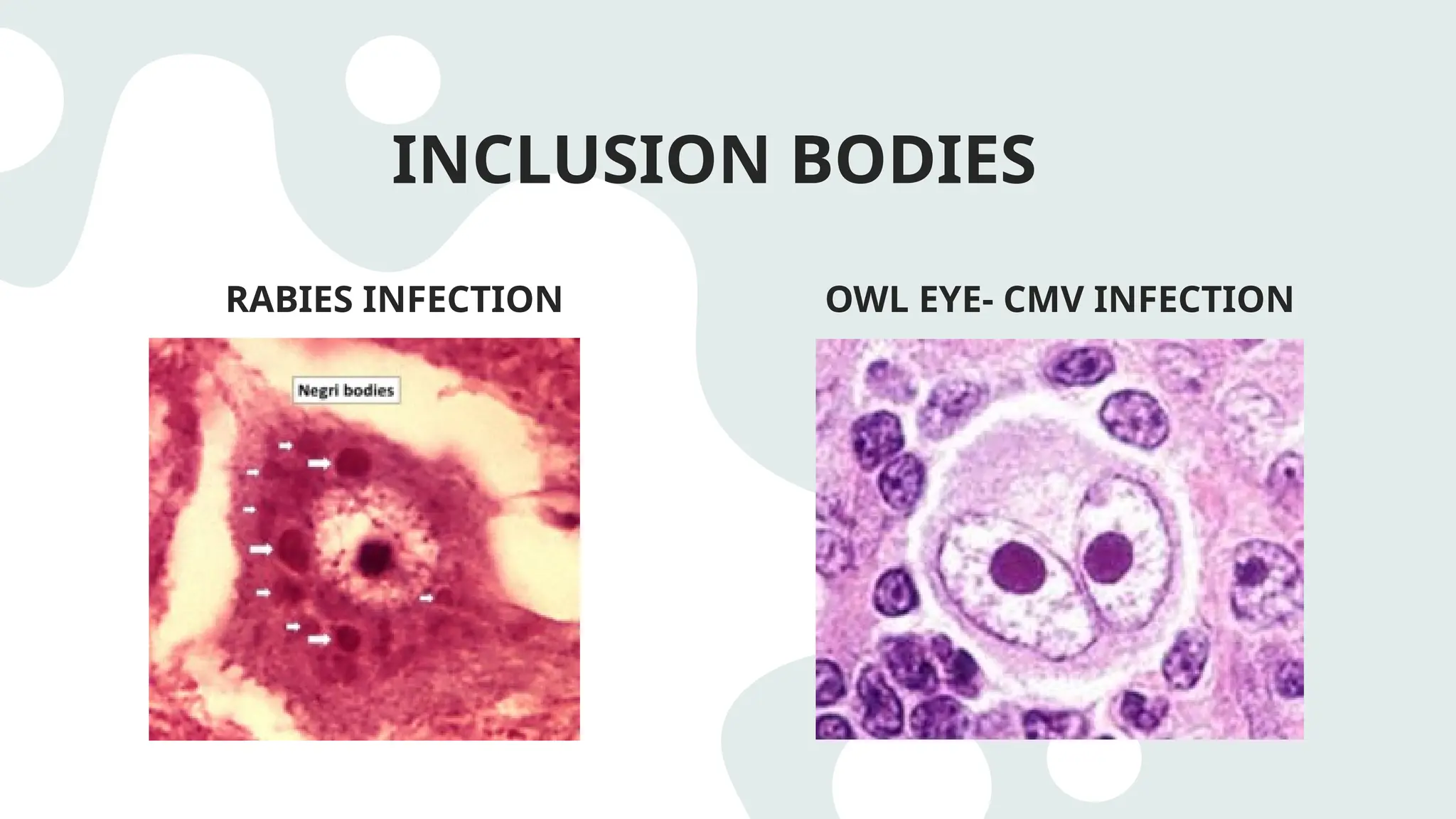 viral pathogenesisviral pathogenesisviral pathogenesisviral ...
