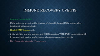 Viral retinitis | PPTX