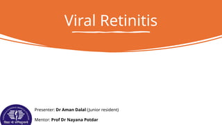 viral retinitis discussion by Dr Aman Dalal | PPTX