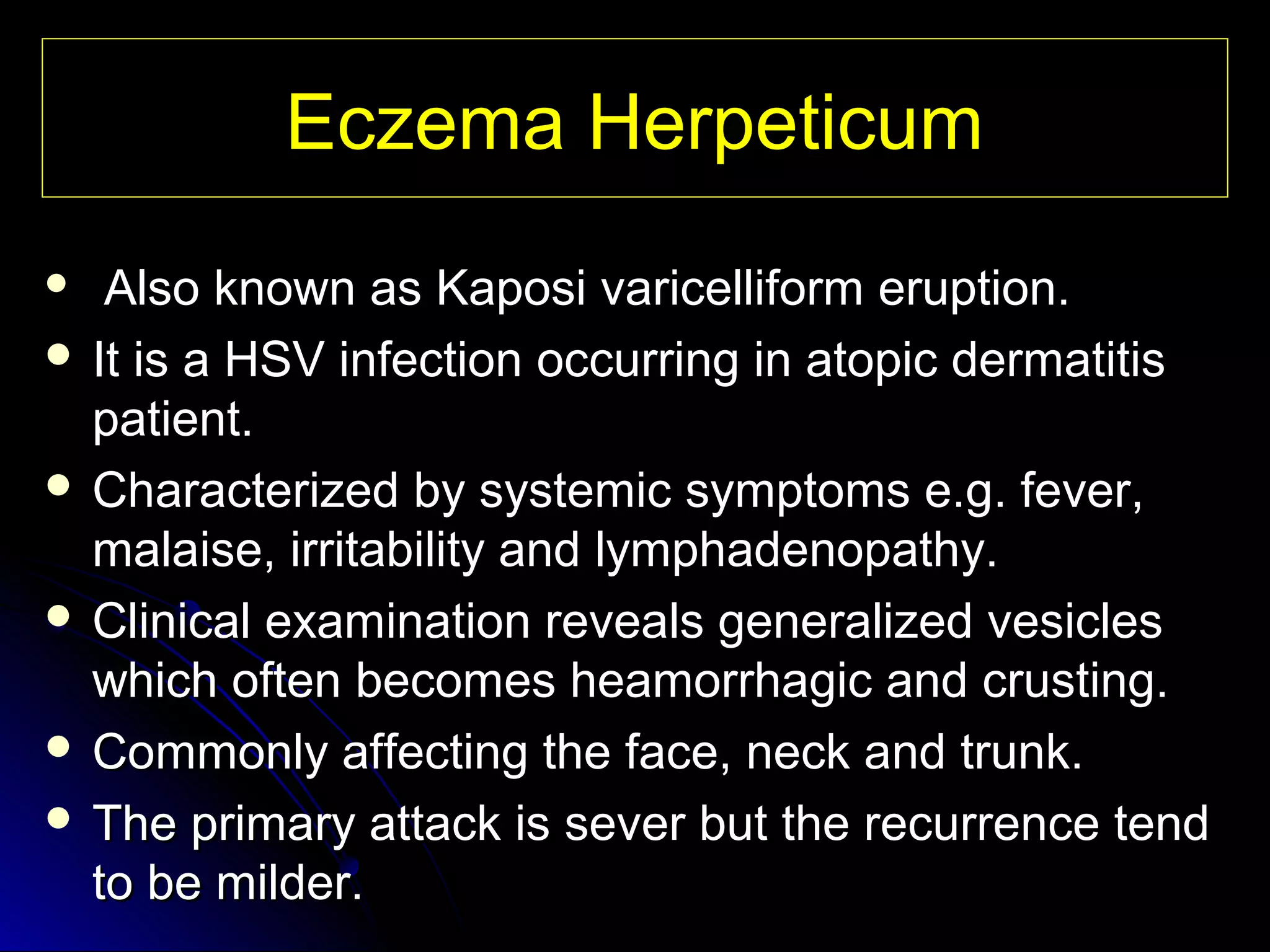 Common Viral Skin Diseases | PPT