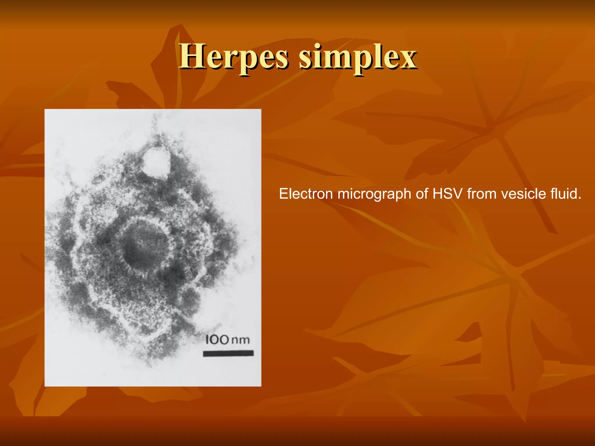 Viral skin infection | PPT