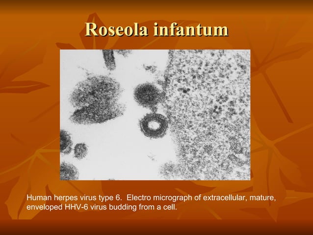 Viral skin infection | PPT