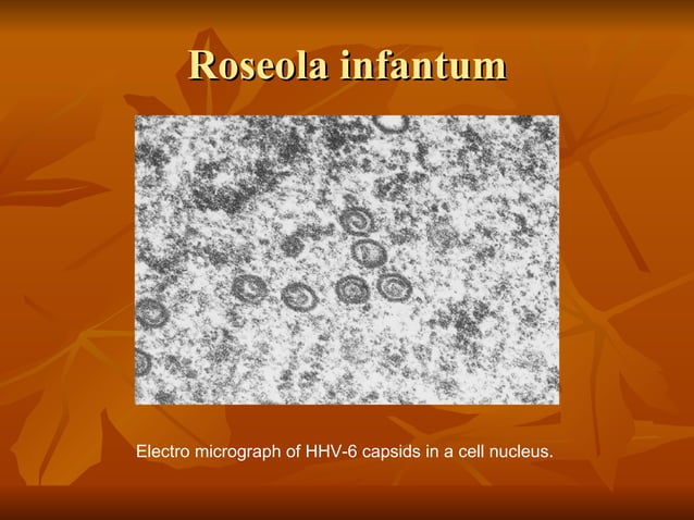 Viral skin infection | PPT