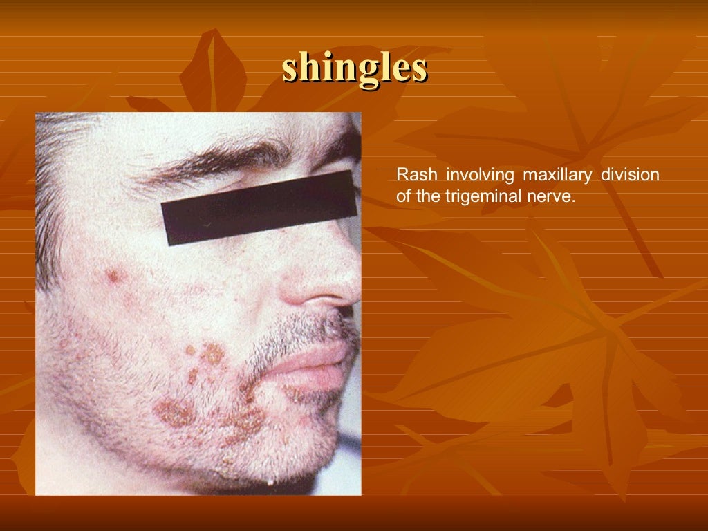 Viral skin infection
