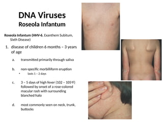 Viral Skin Infections Clinical Pathology Study Questions_Mari-Alina ...