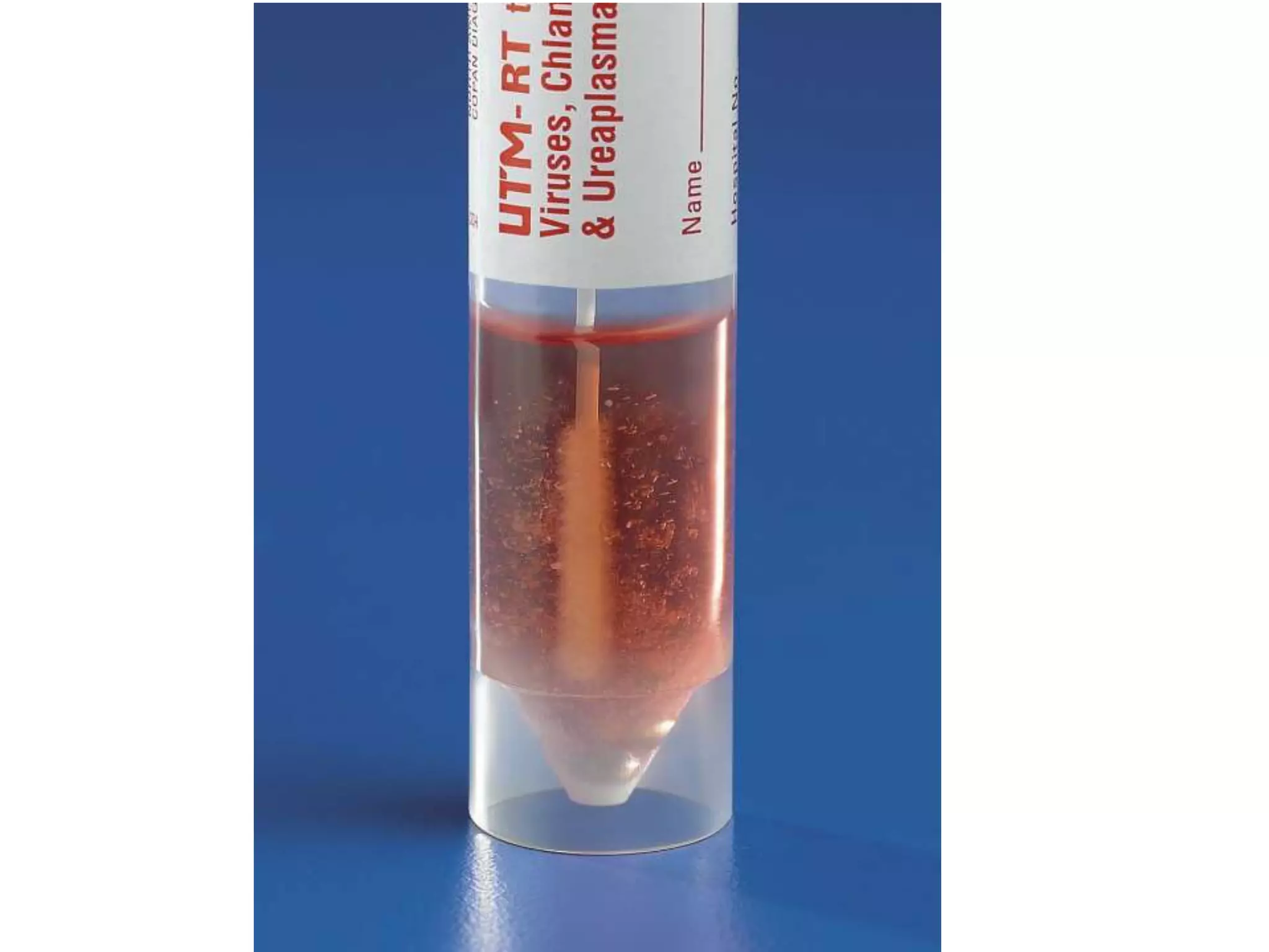 Viral Transport Medium | PPSX