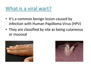 Viral warts | PPT
