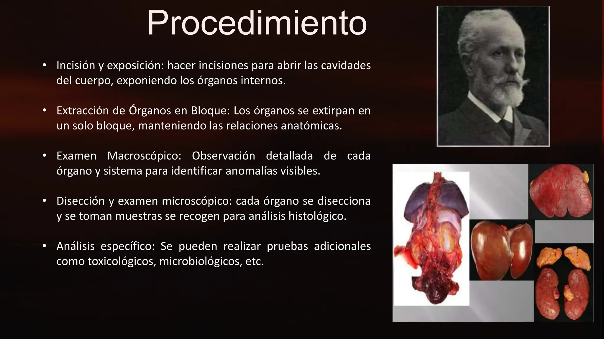 Virchow y Letulle-1.pptx métodos Necropsia | PPTX