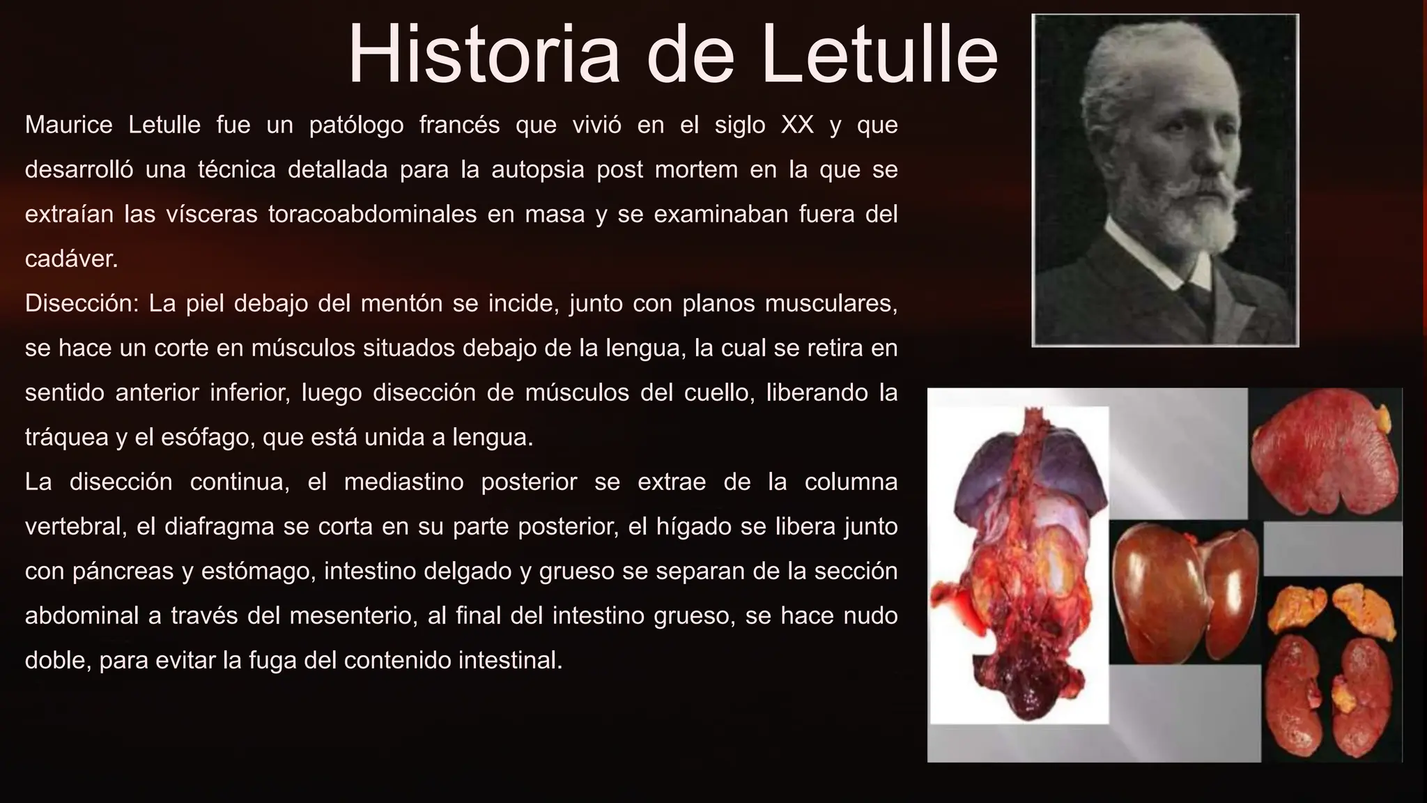 Virchow y Letulle-1.pptx métodos Necropsia | PPTX