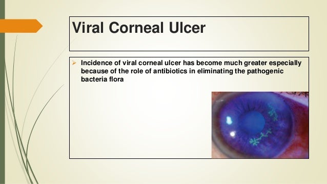 Common viral eye diseases & treatment