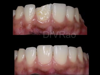 Class 4 buildup ( Style italiano recipes) | PPT