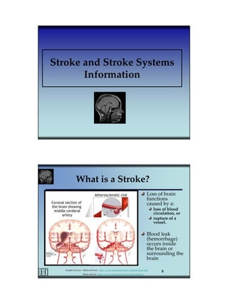 Virginia Stroke Systems | PDF