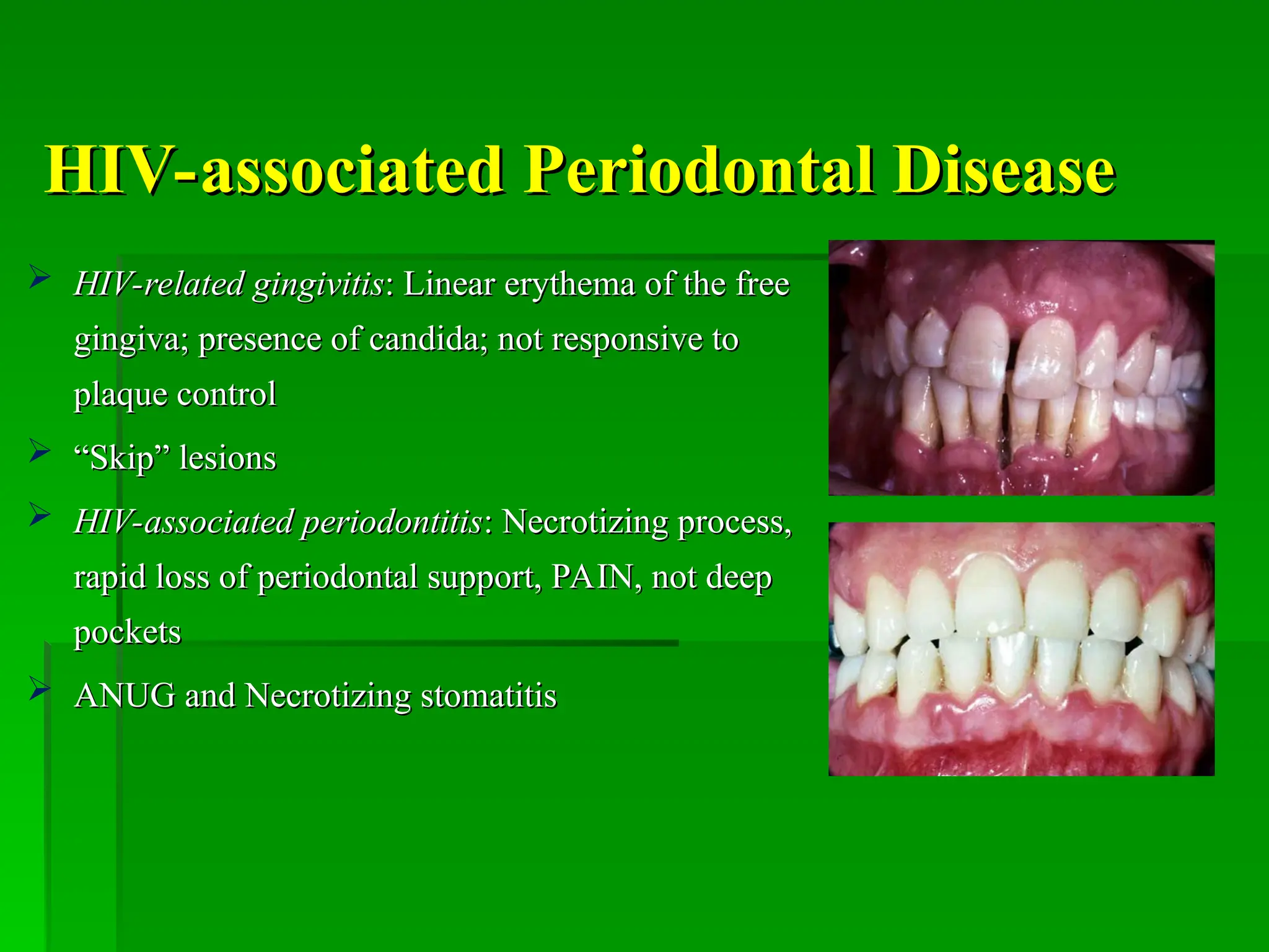 Virology Dentistry. Summary of infections .ppt