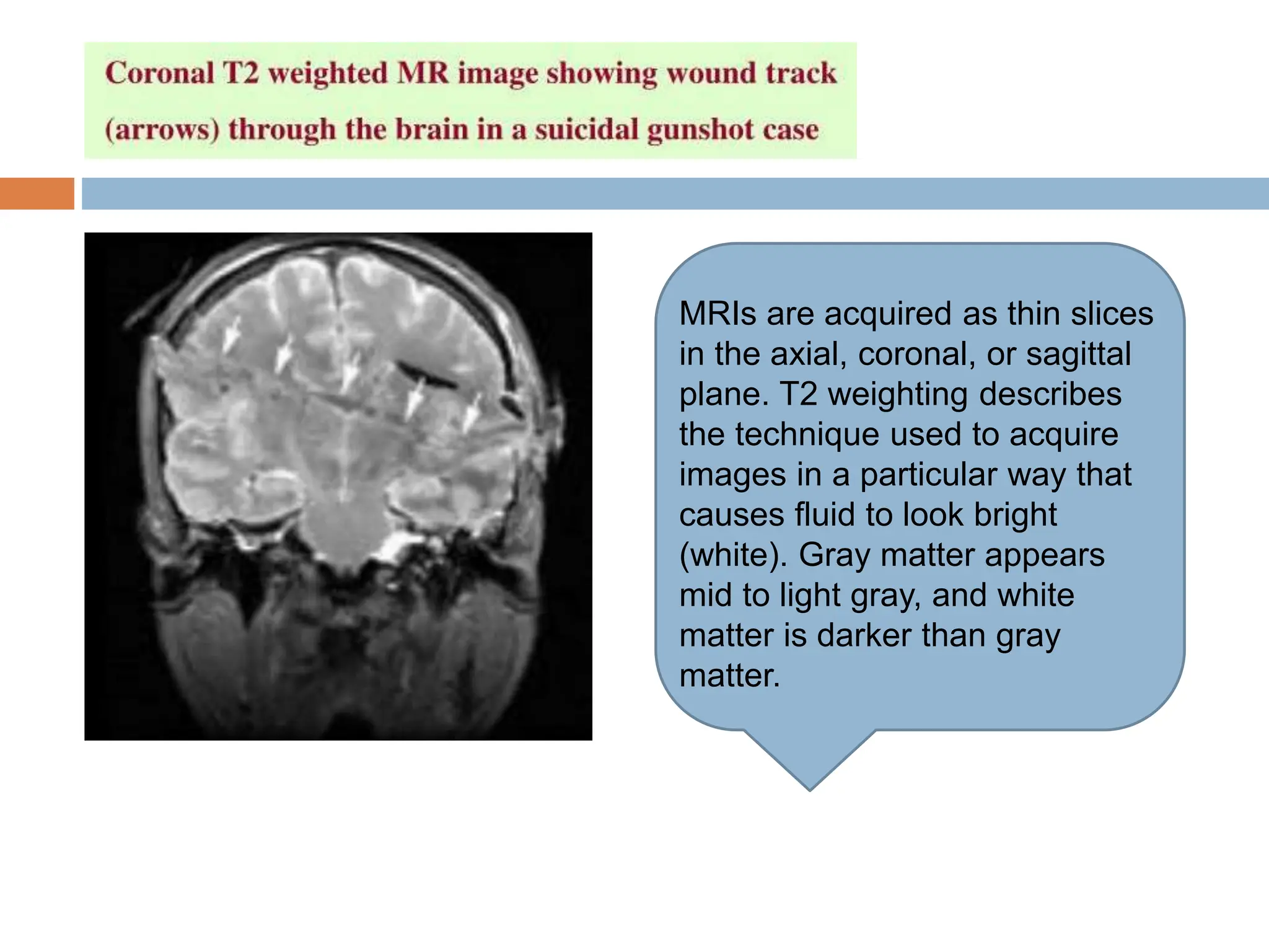 Virtual Autopsy Forensic medicine and toxicology | PPTX