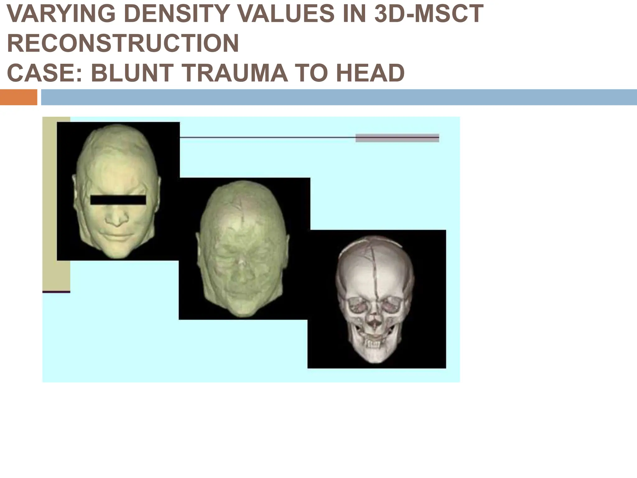 Virtual Autopsy Forensic medicine and toxicology | PPTX