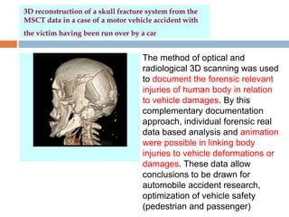 Virtual Autopsy Forensic medicine and toxicology | PPTX