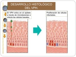 Virus del papiloma humano | PPTX