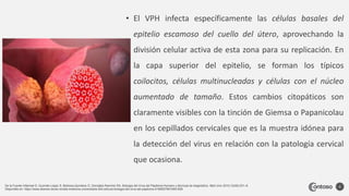 VIRUS DEL PAPILOMA HUMANO. GENERALIDADES.pptx
