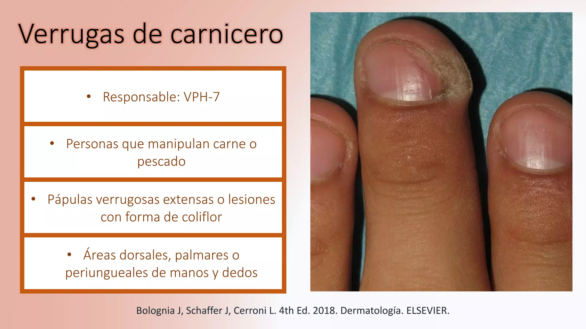 Infección por el Virus del Papiloma Humano (VPH): Verrugas Cutáneas y ...