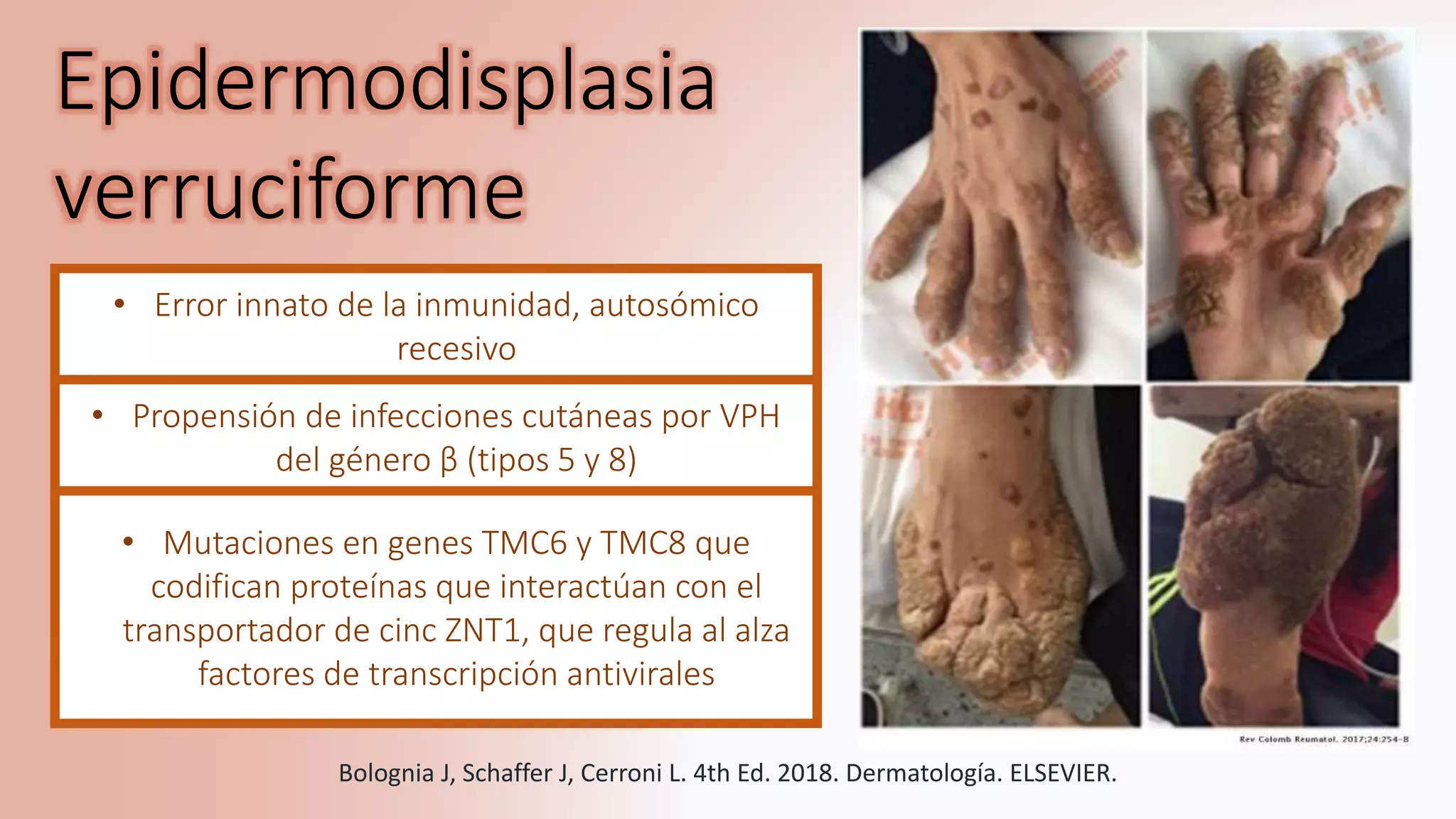 Infección por el Virus del Papiloma Humano (VPH): Verrugas Cutáneas y ...