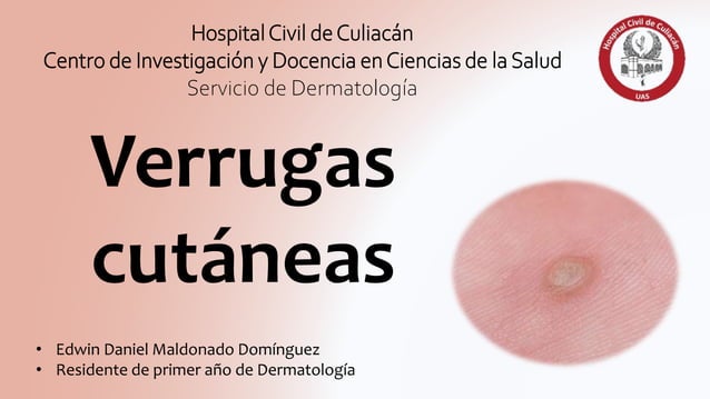 Infección por el Virus del Papiloma Humano (VPH): Verrugas Cutáneas y ...