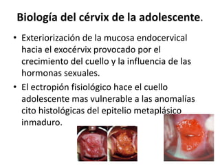 Virus del papiloma humano y adolescencia | PPTX