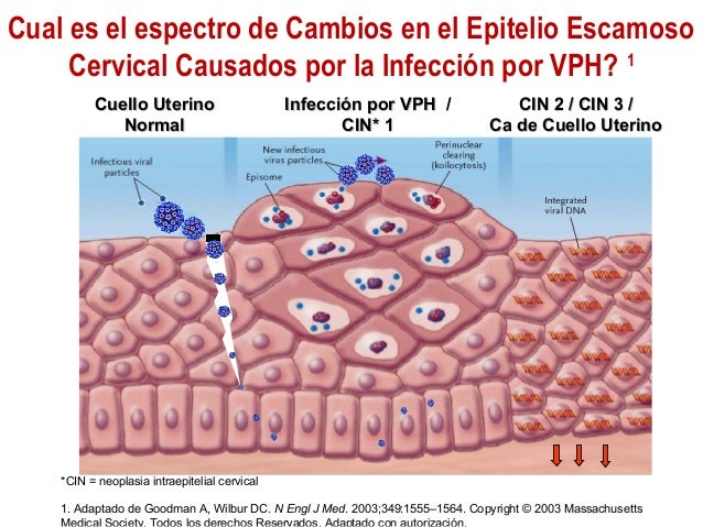 Virus de papiloma humano