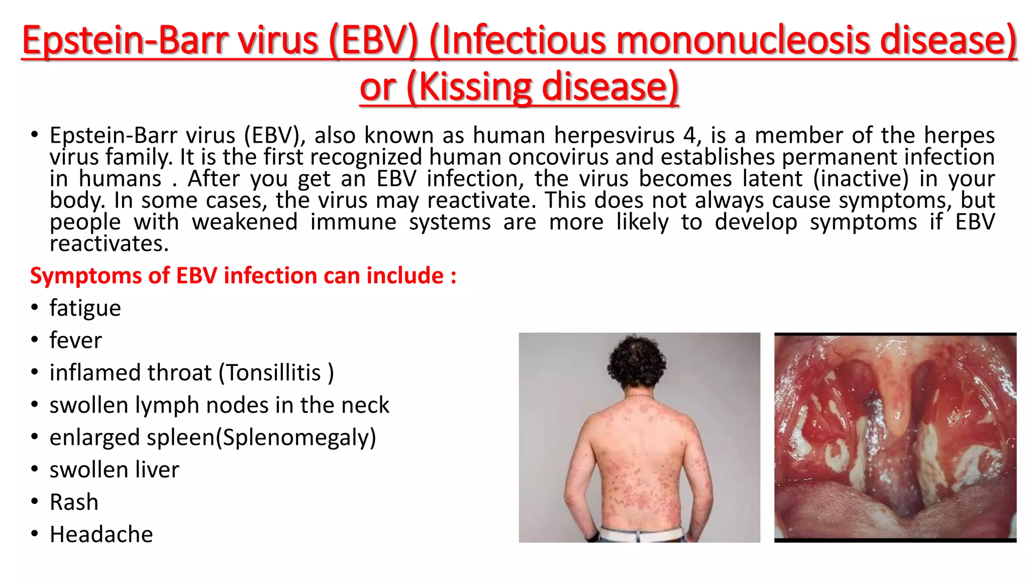 Viruses Causing Cancer.pptx