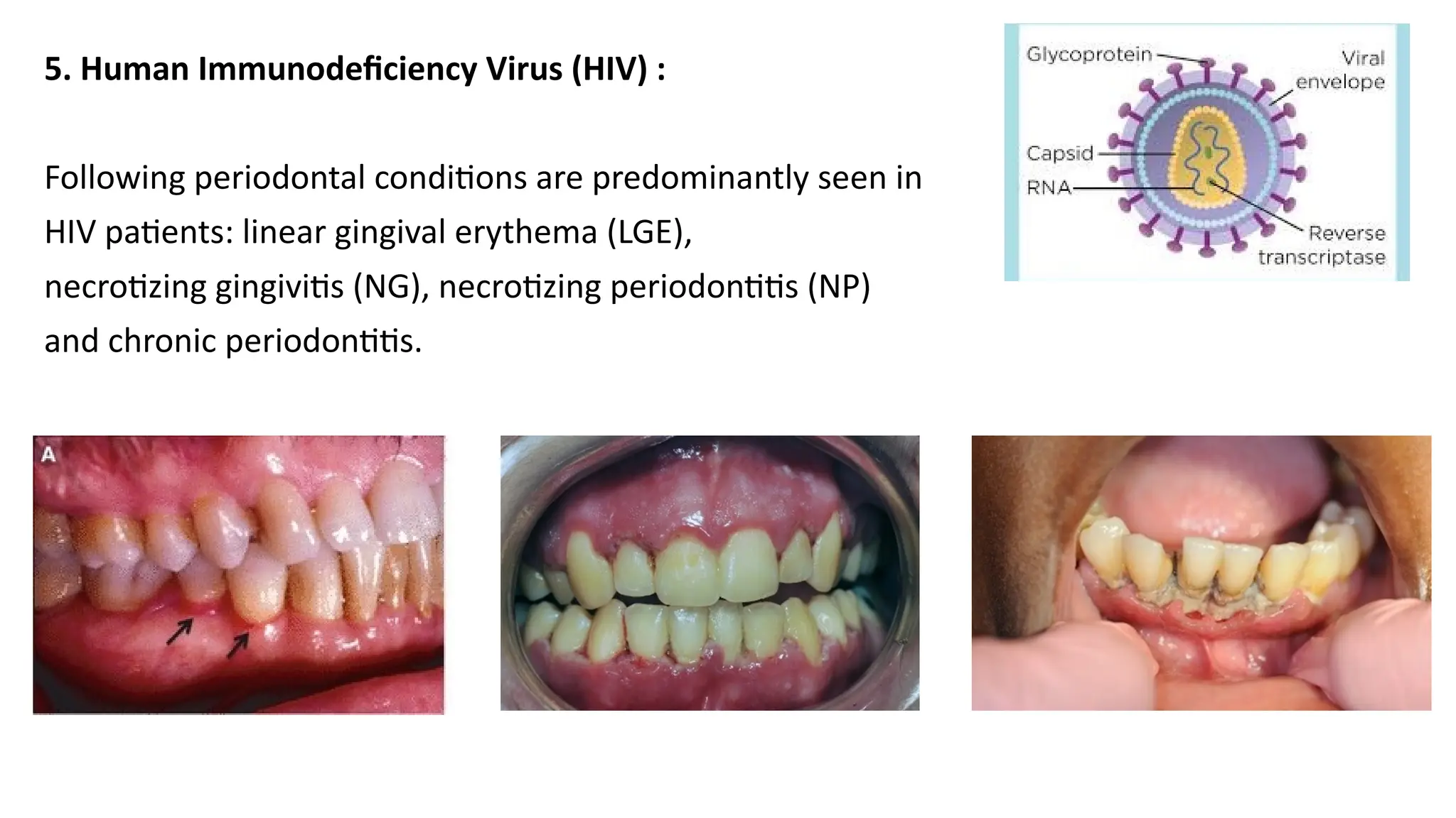viruses in periodontics and their effects | PPTX