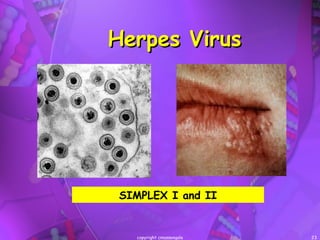 Viruses, viroids, and prions | PPT
