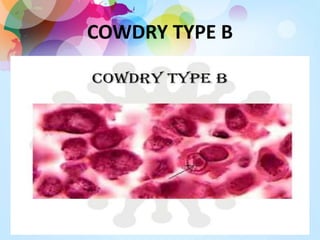 Cowdry Type A