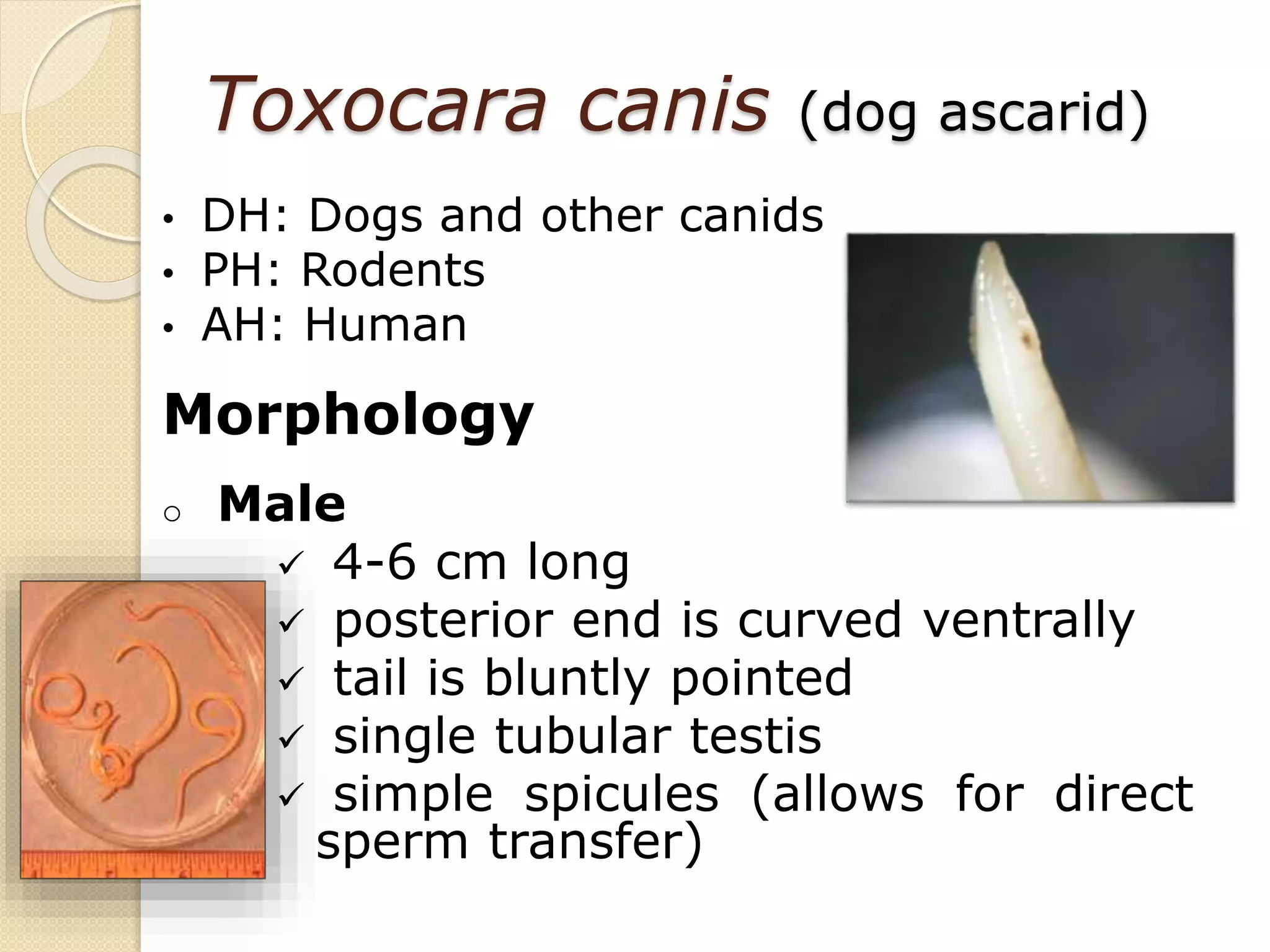 Visceral Larva Migrans Examples